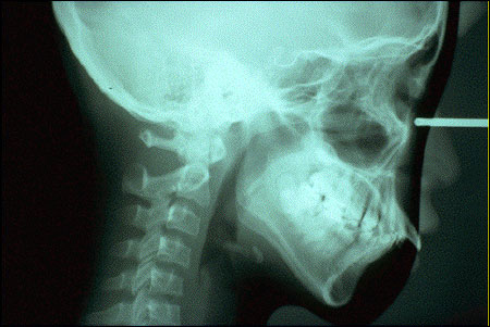 index [inaortho.com]